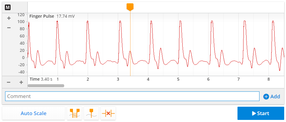 Data Sampling in Lt | ADInstruments